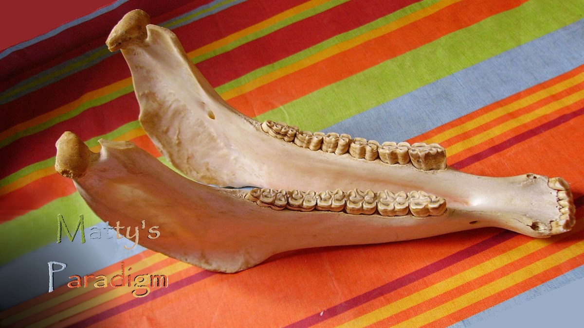 The Jawbone End Run – Matty's Paradigm